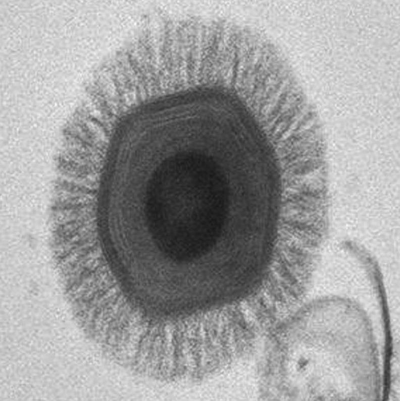 The largest viral genome from a human | Virology Blog