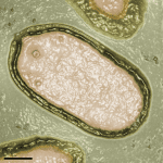 Pandoravirus, bigger and unlike anything seen before | Virology Blog