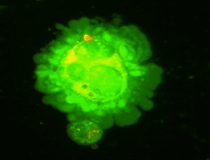 NDV infected glioma cells | Virology Blog