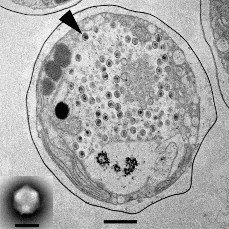 Fermentation genes in a giant algal virus | Virology Blog